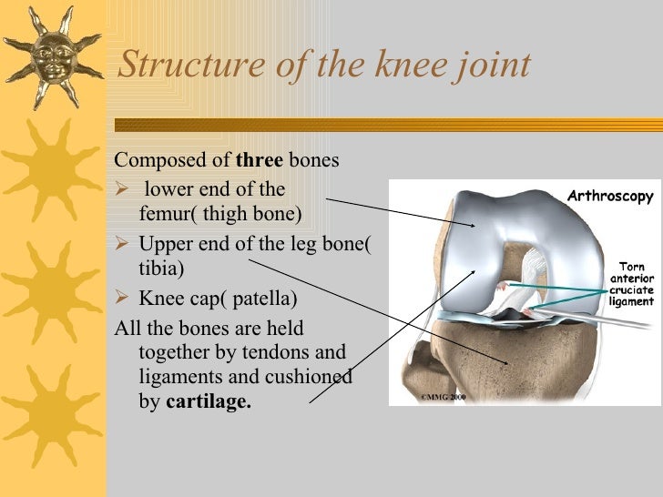Gender Specific High Flex Knee replacement