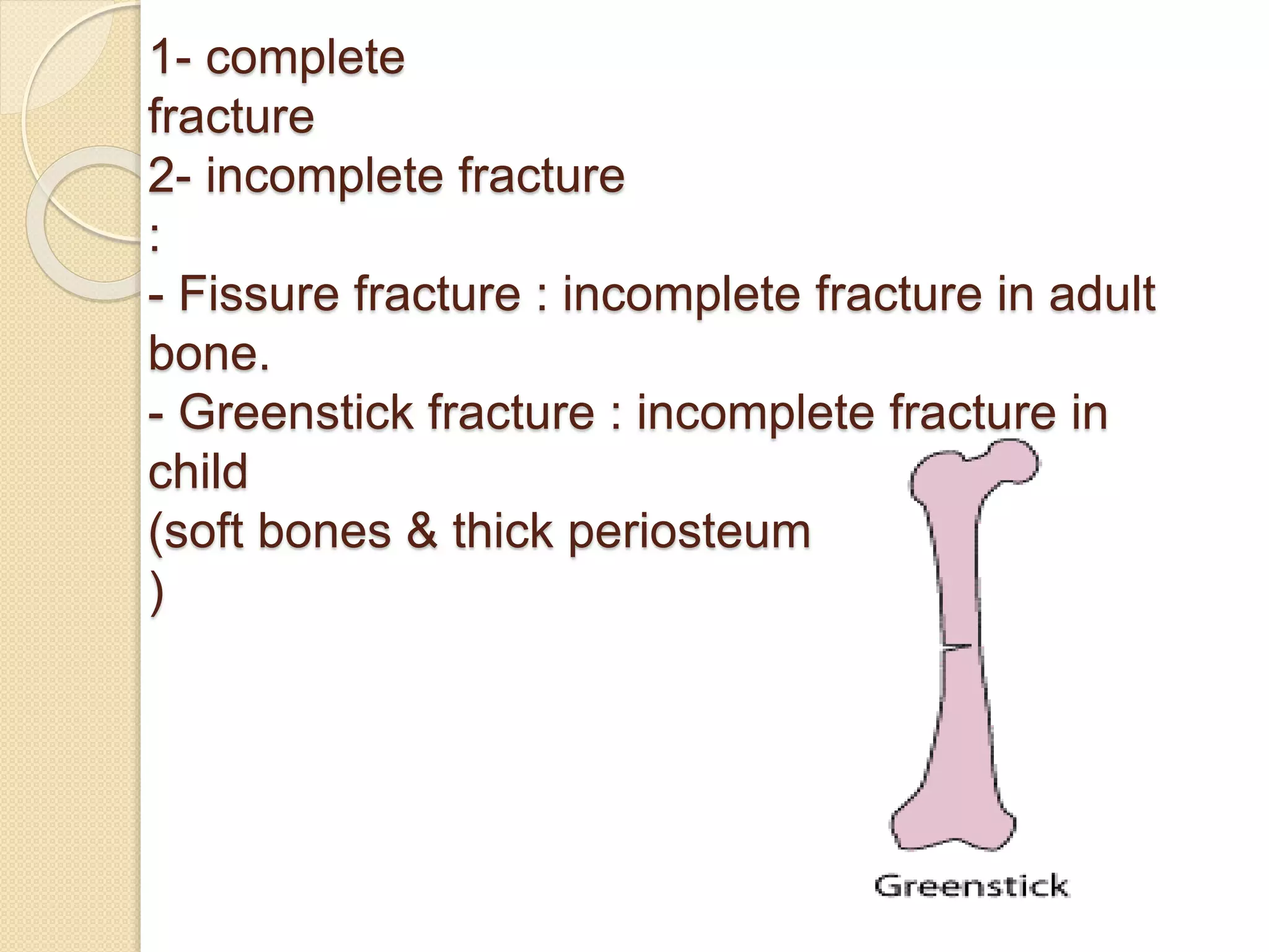 Geneal Principle of fracture | PPTX
