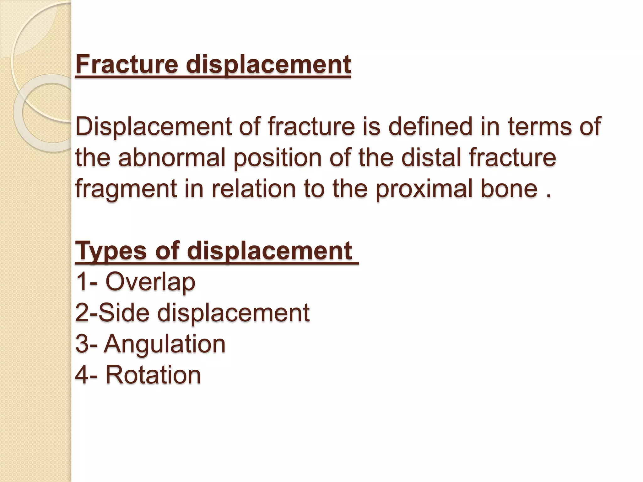 Geneal Principle of fracture | PPTX
