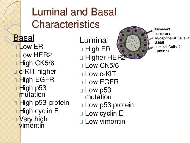 Gene expression profiling in breast carcinoma