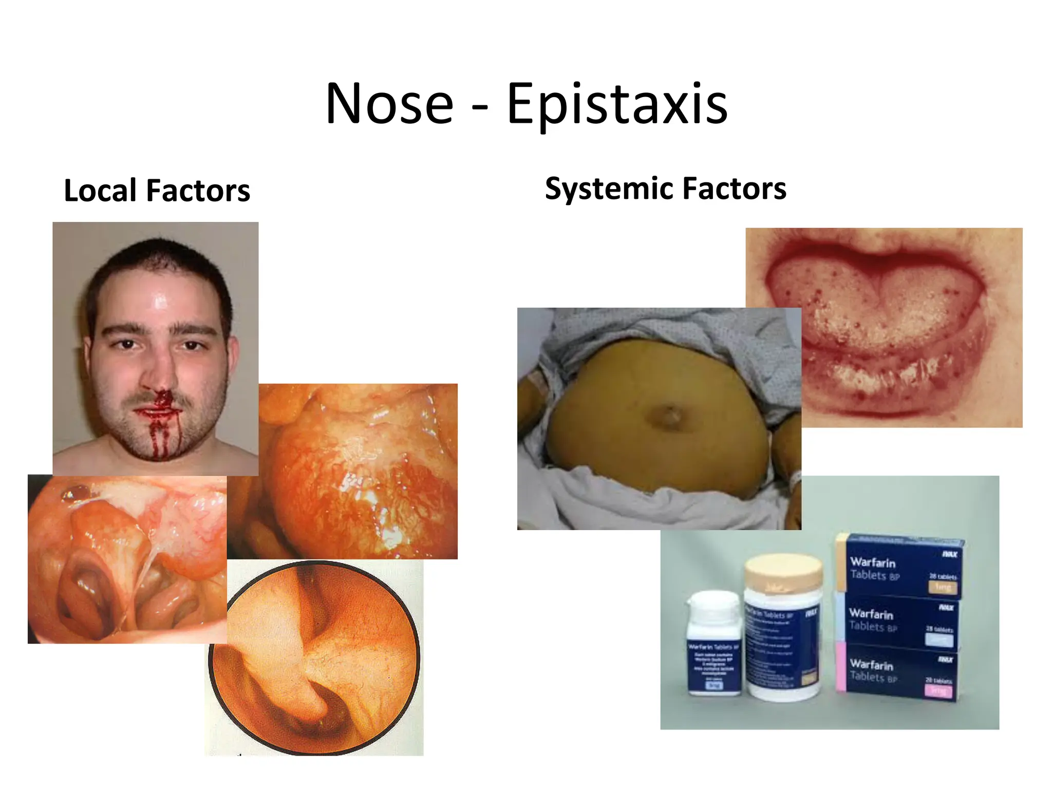 General ENT Emergency common ent emergencies | PDF