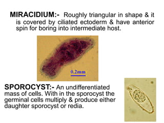 Life-cycle-of-trematodes which will enrich your knowledge if you are ...