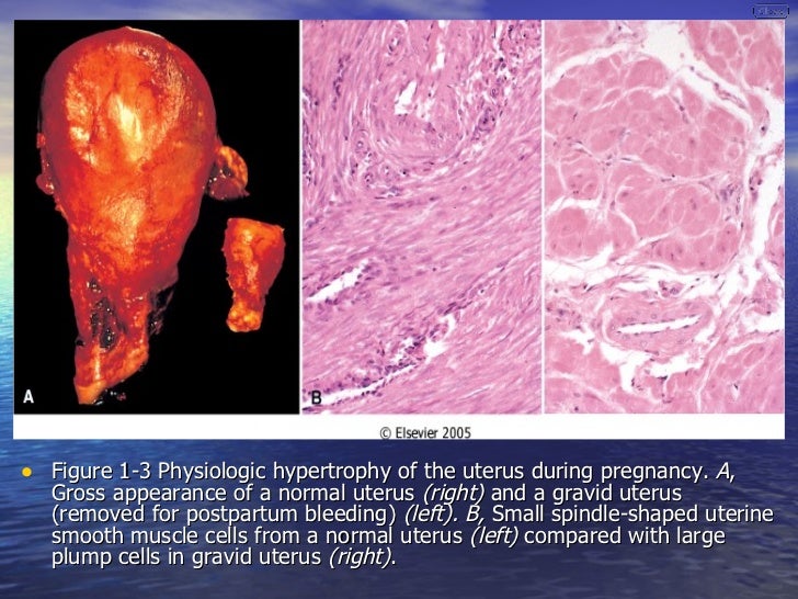 General Pathology Review