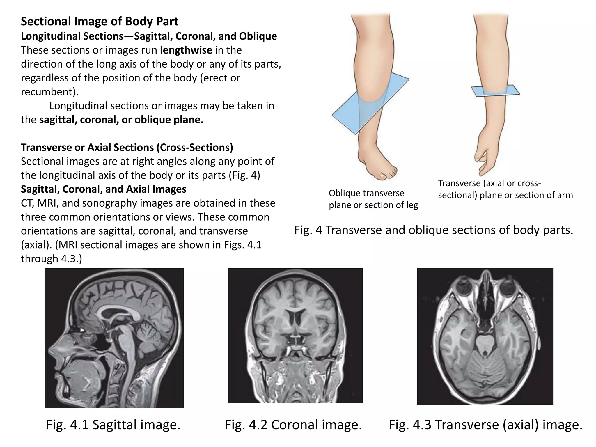 General radiological-procedure | PPTX