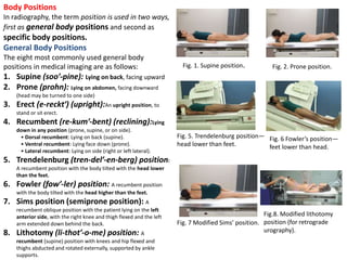 General radiological-procedure | PPTX
