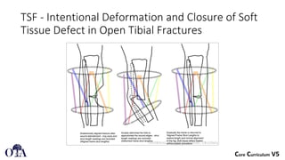 General A7 Principles of External Fixation.pdf