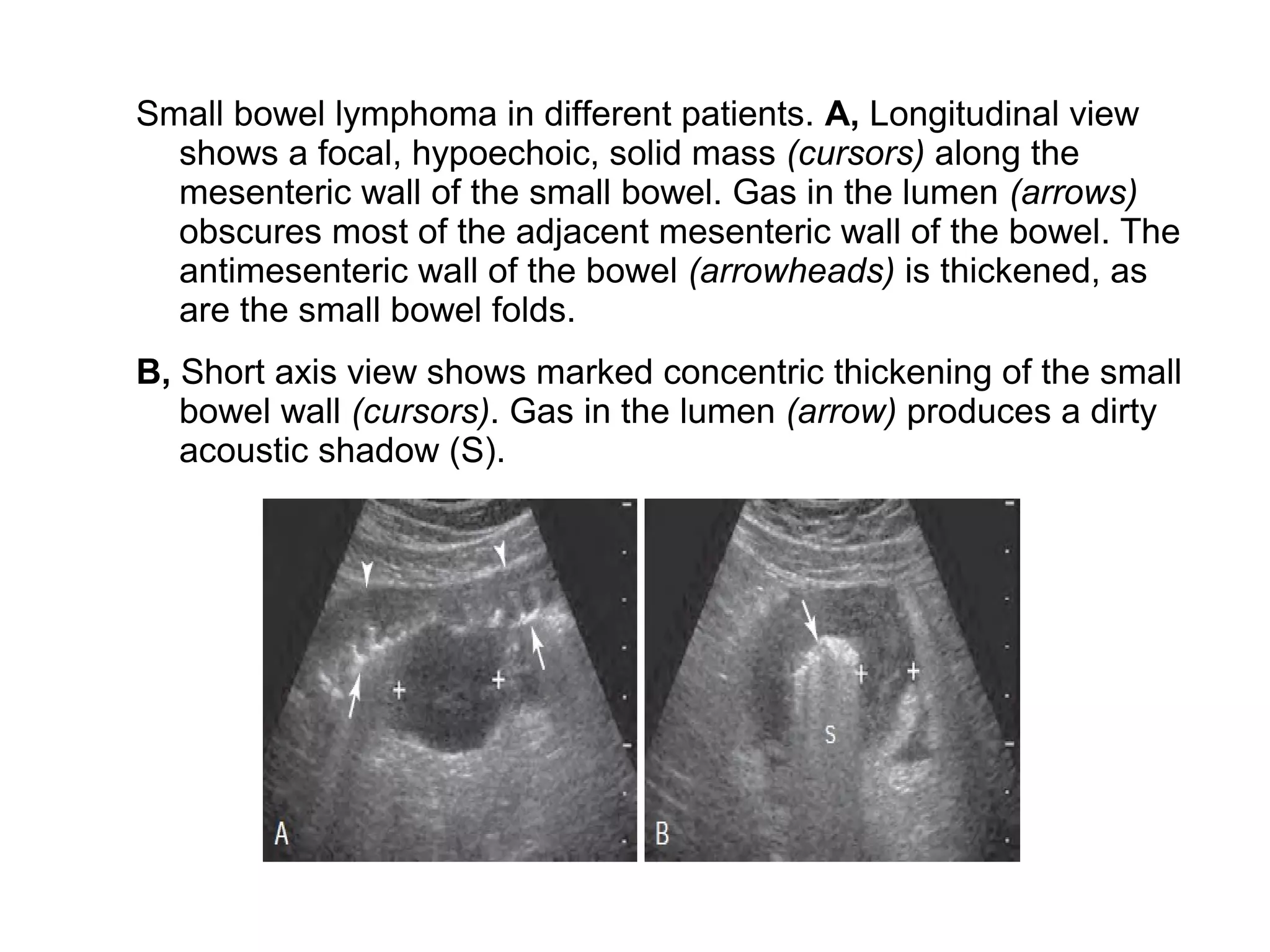 General abdomen ultrasound sonography | PPT