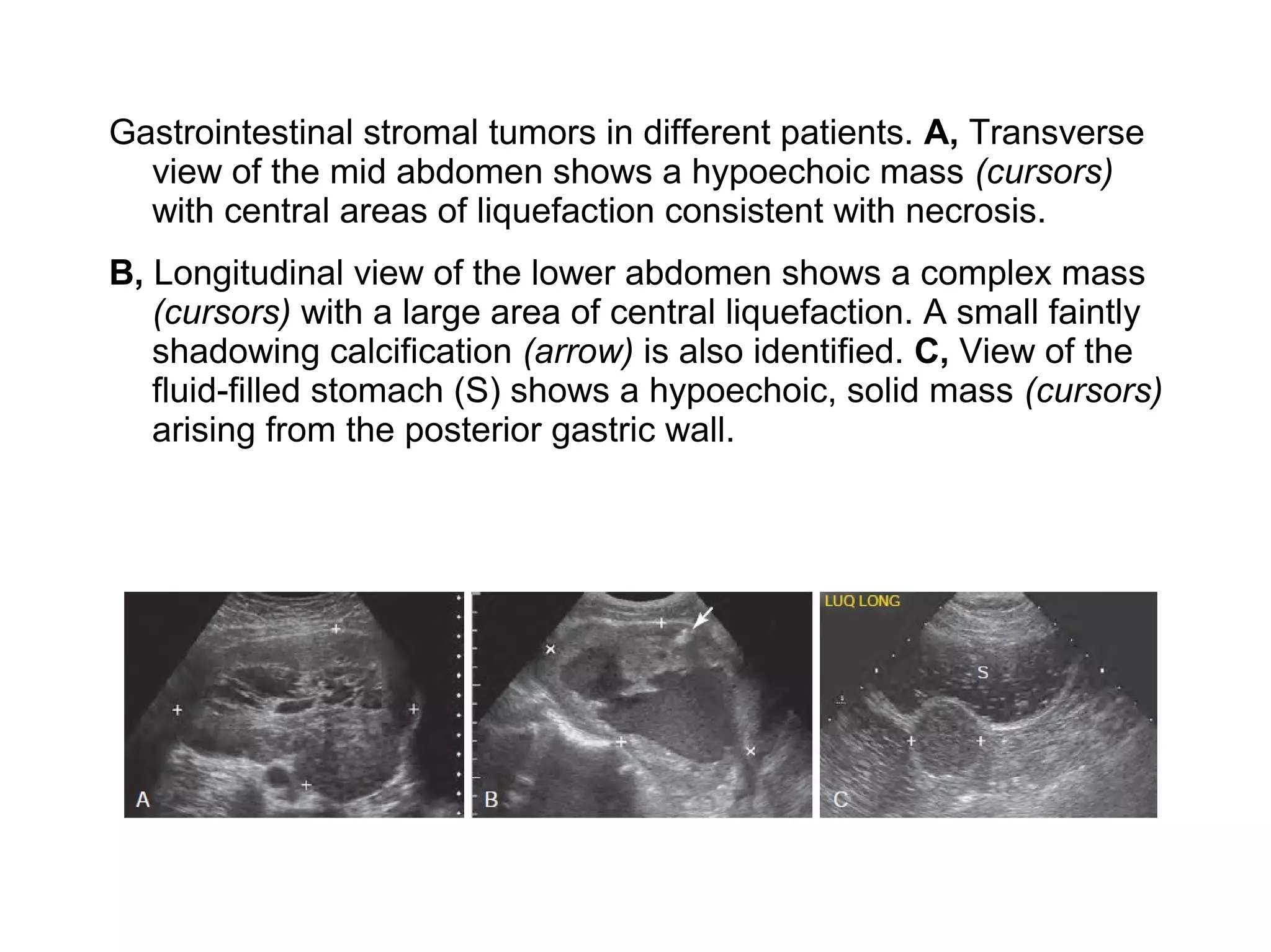General abdomen ultrasound sonography | PPT
