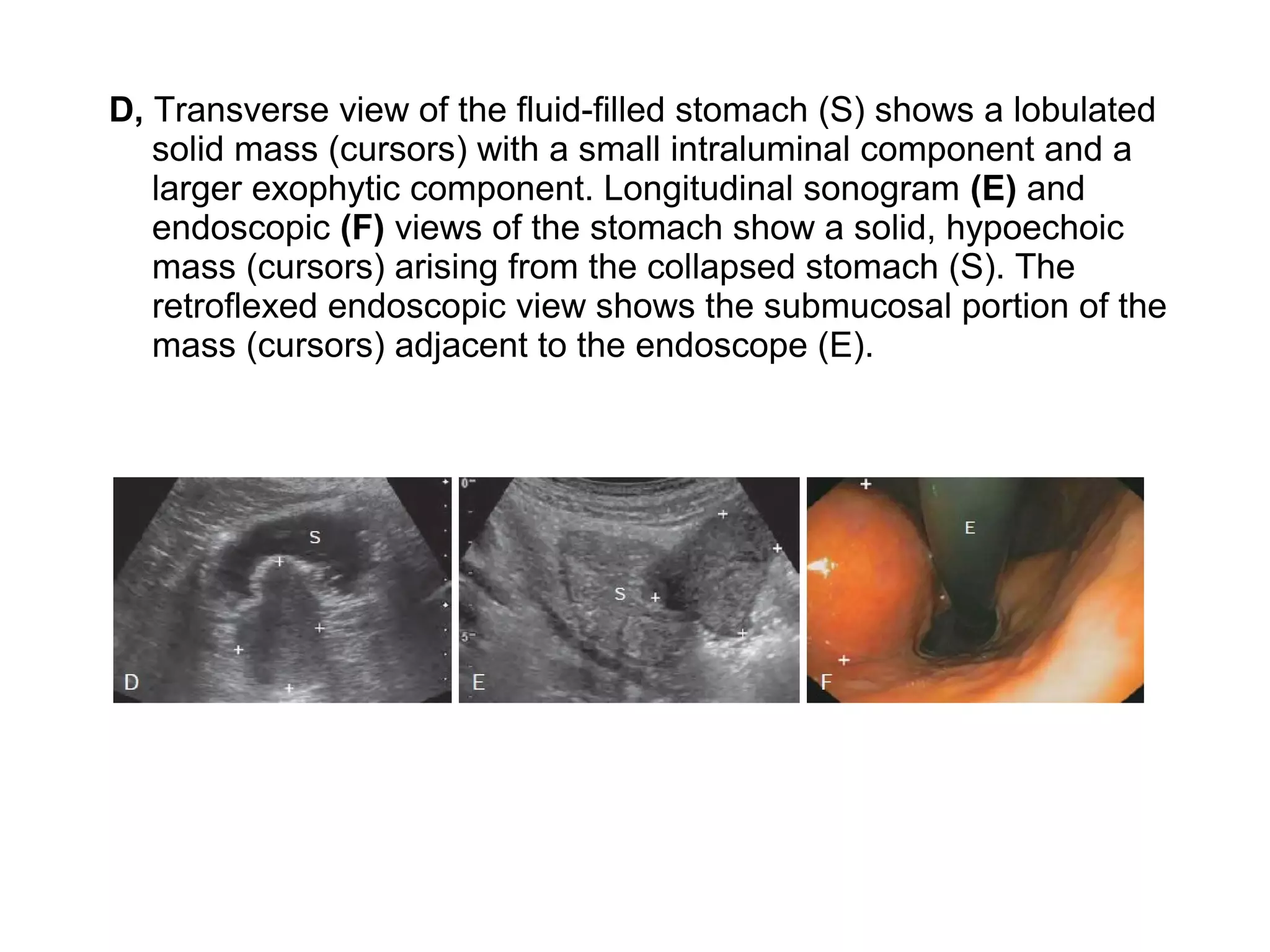 General abdomen ultrasound sonography | PPT