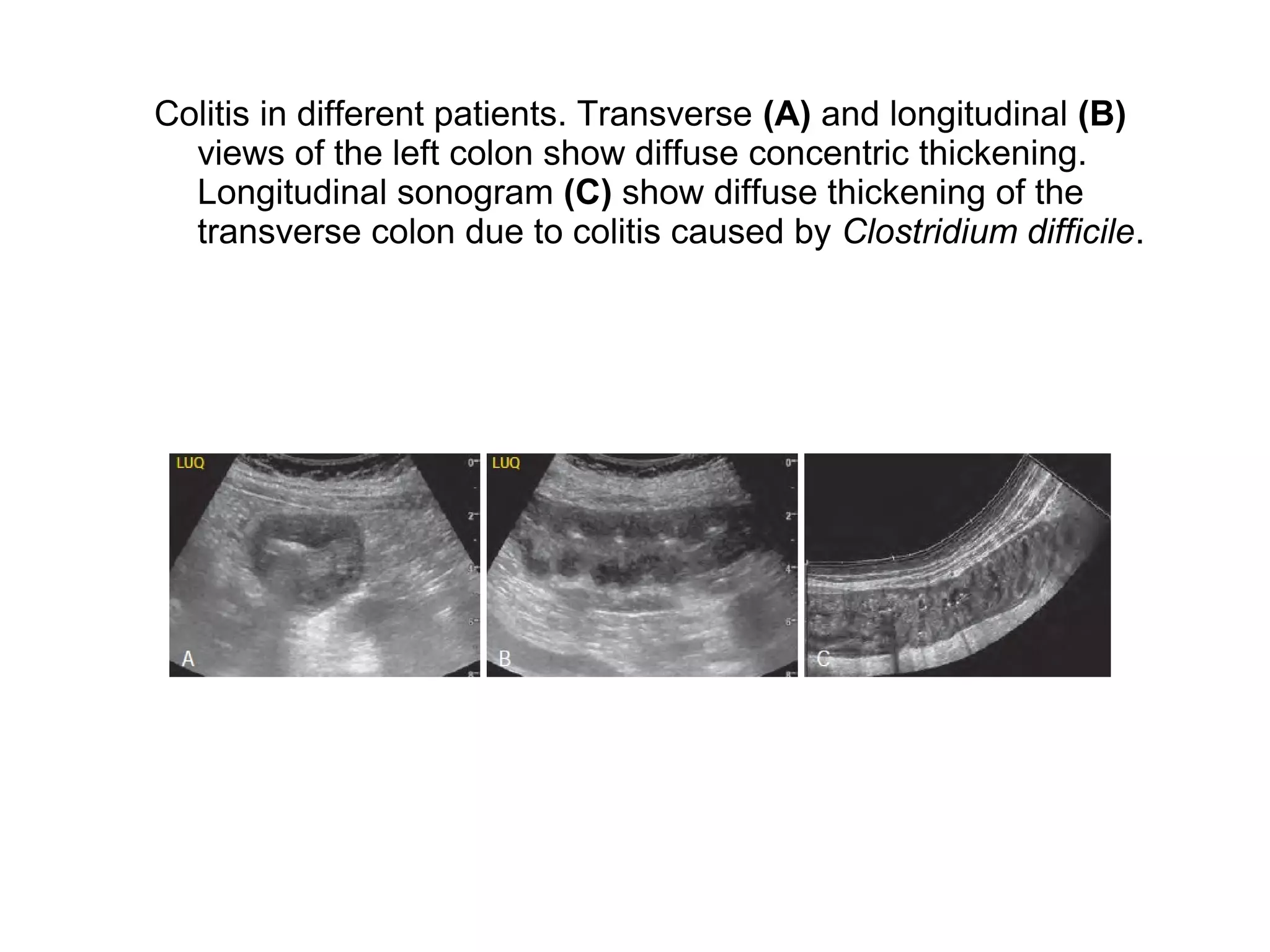 General abdomen ultrasound sonography | PPT