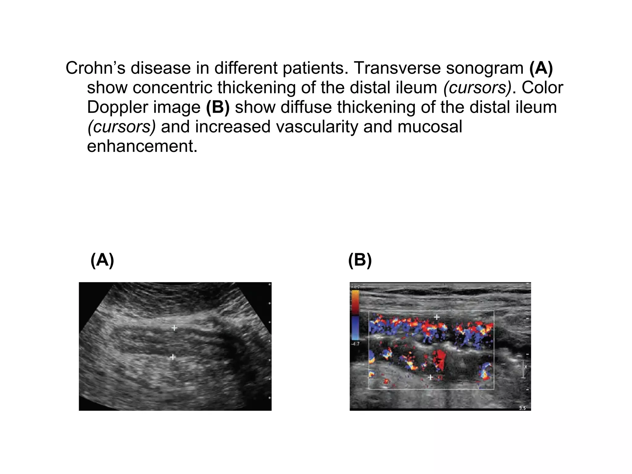 General abdomen ultrasound sonography | PPT