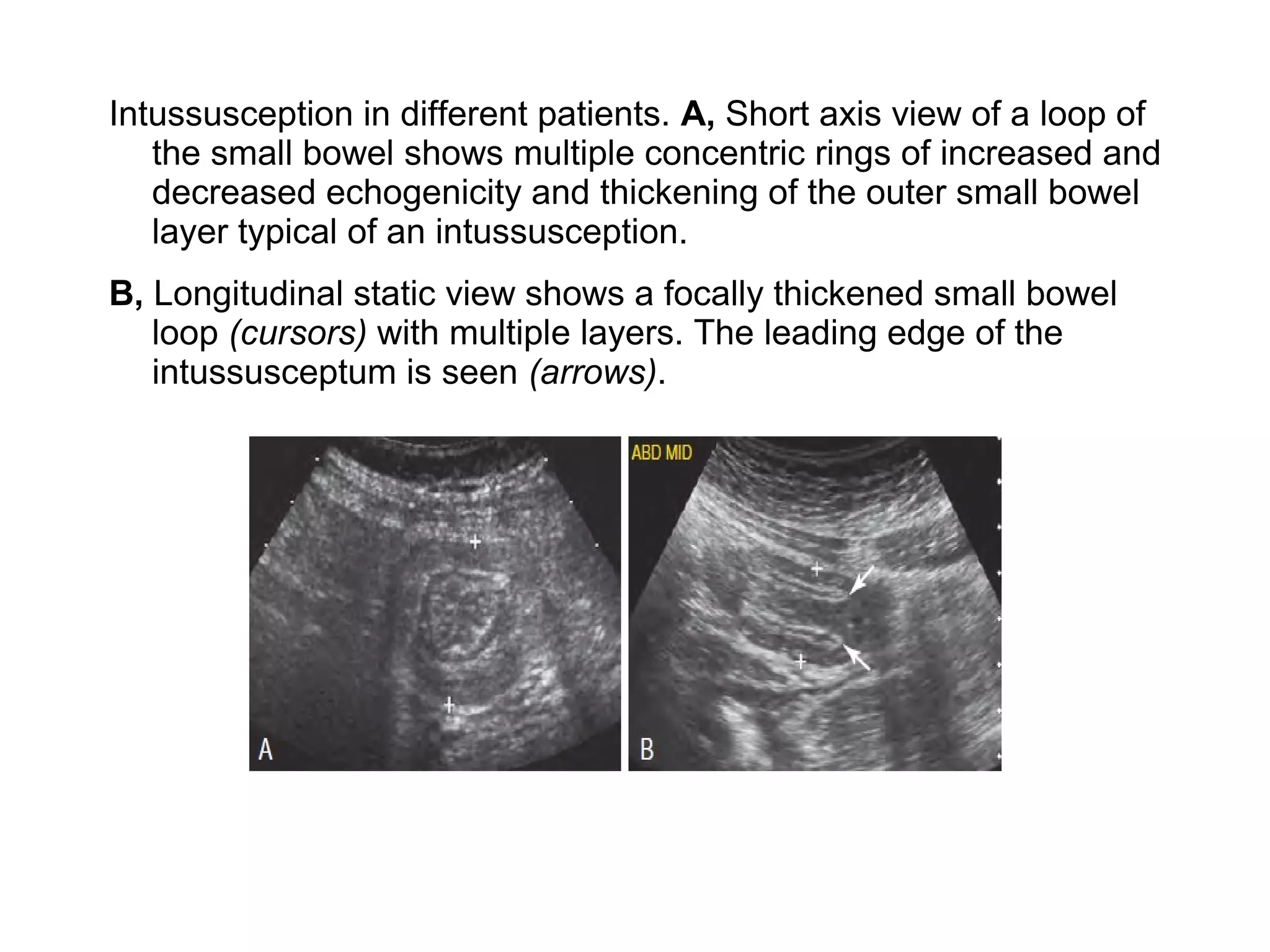 General abdomen ultrasound sonography | PPT