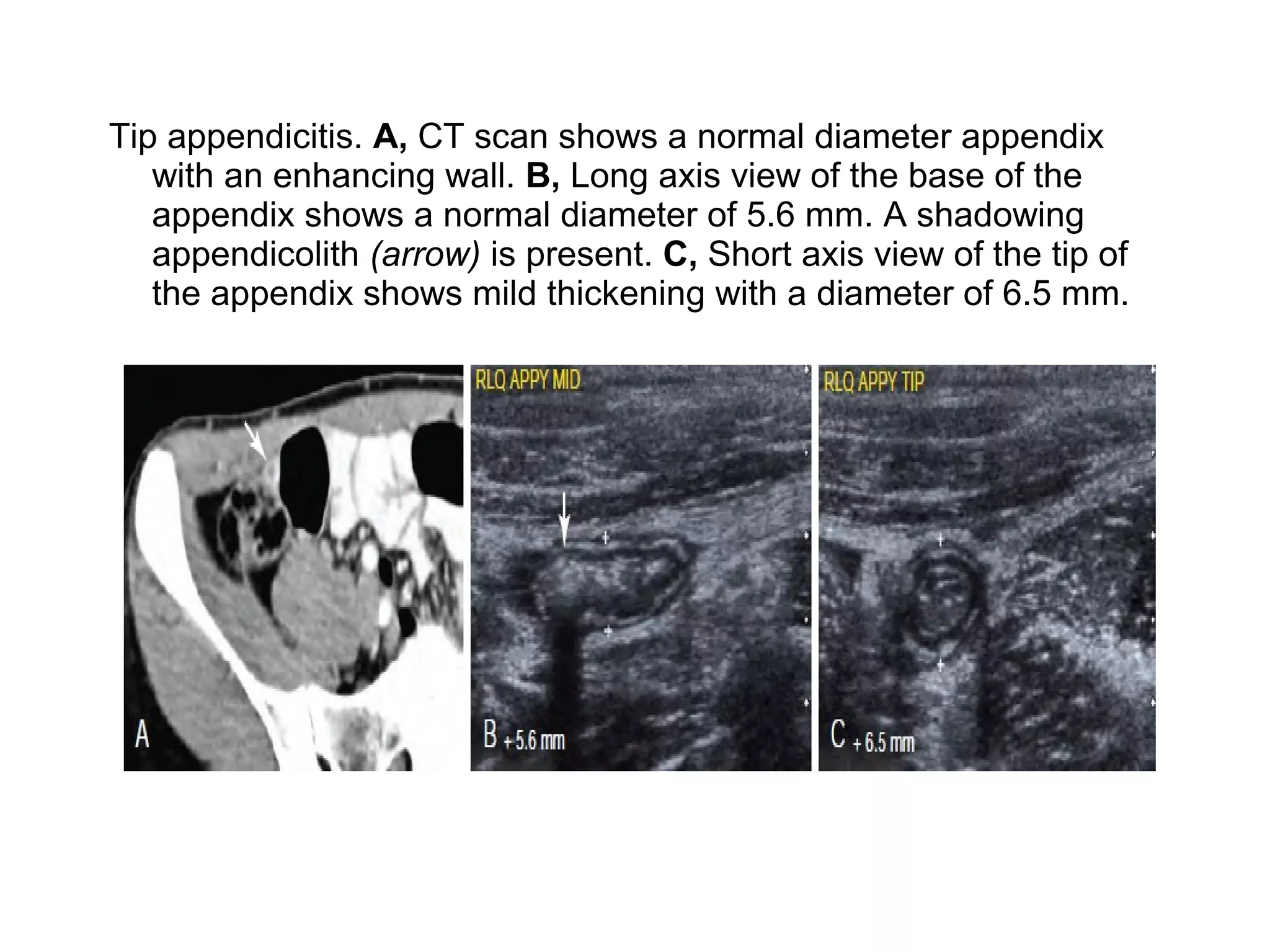 General abdomen ultrasound sonography | PPT