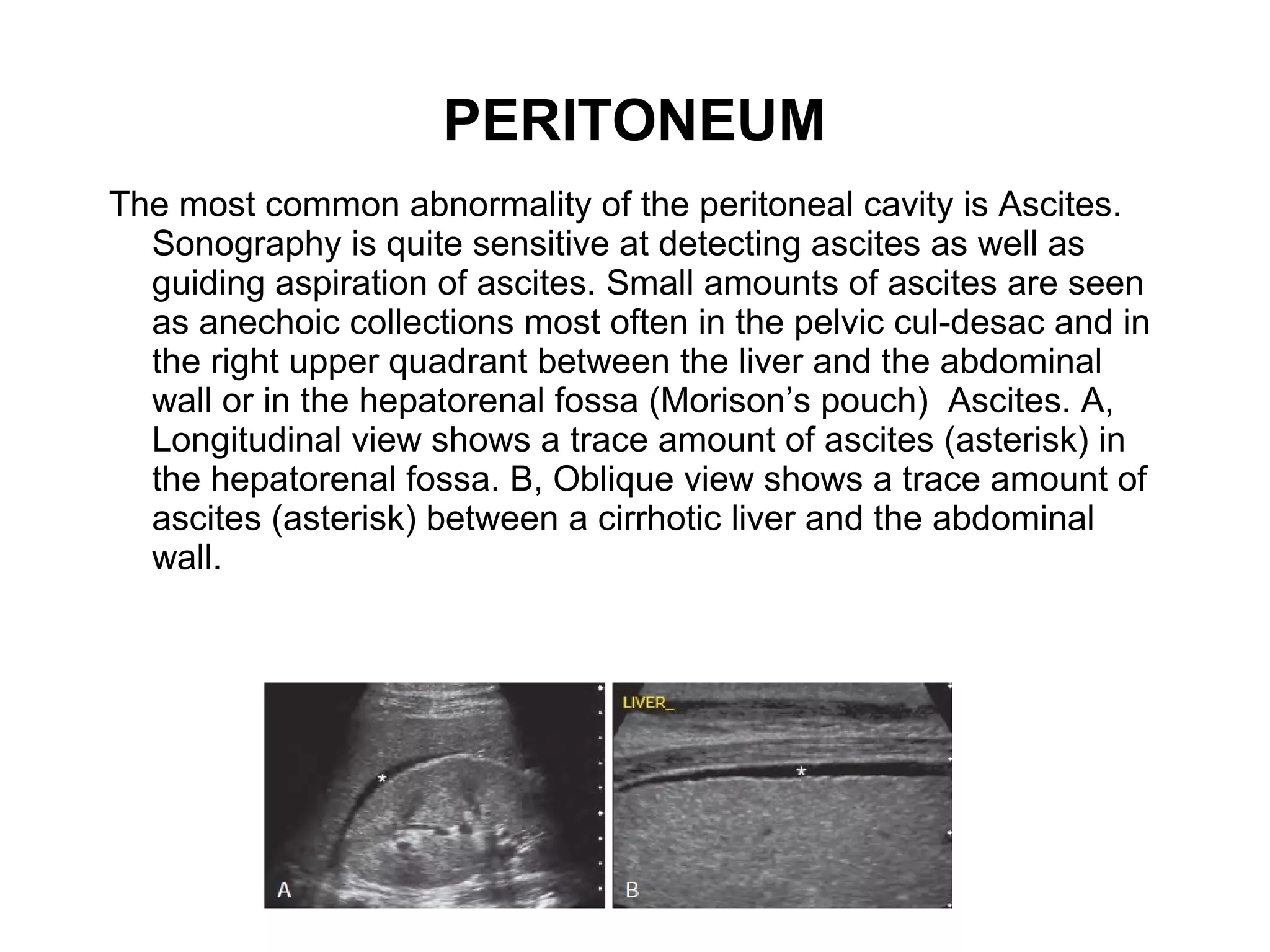 General abdomen ultrasound sonography | PPT