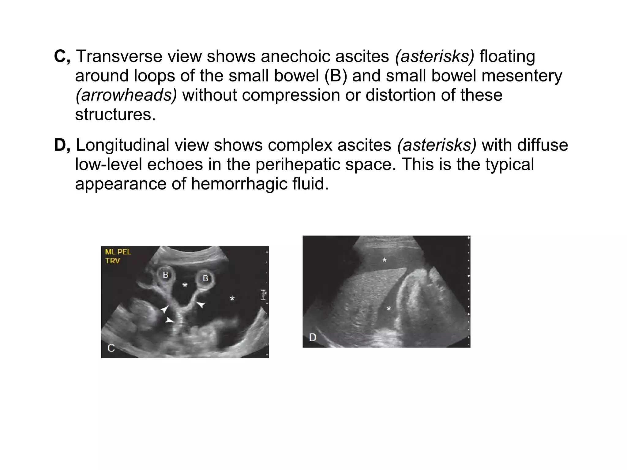 General abdomen ultrasound sonography | PPT