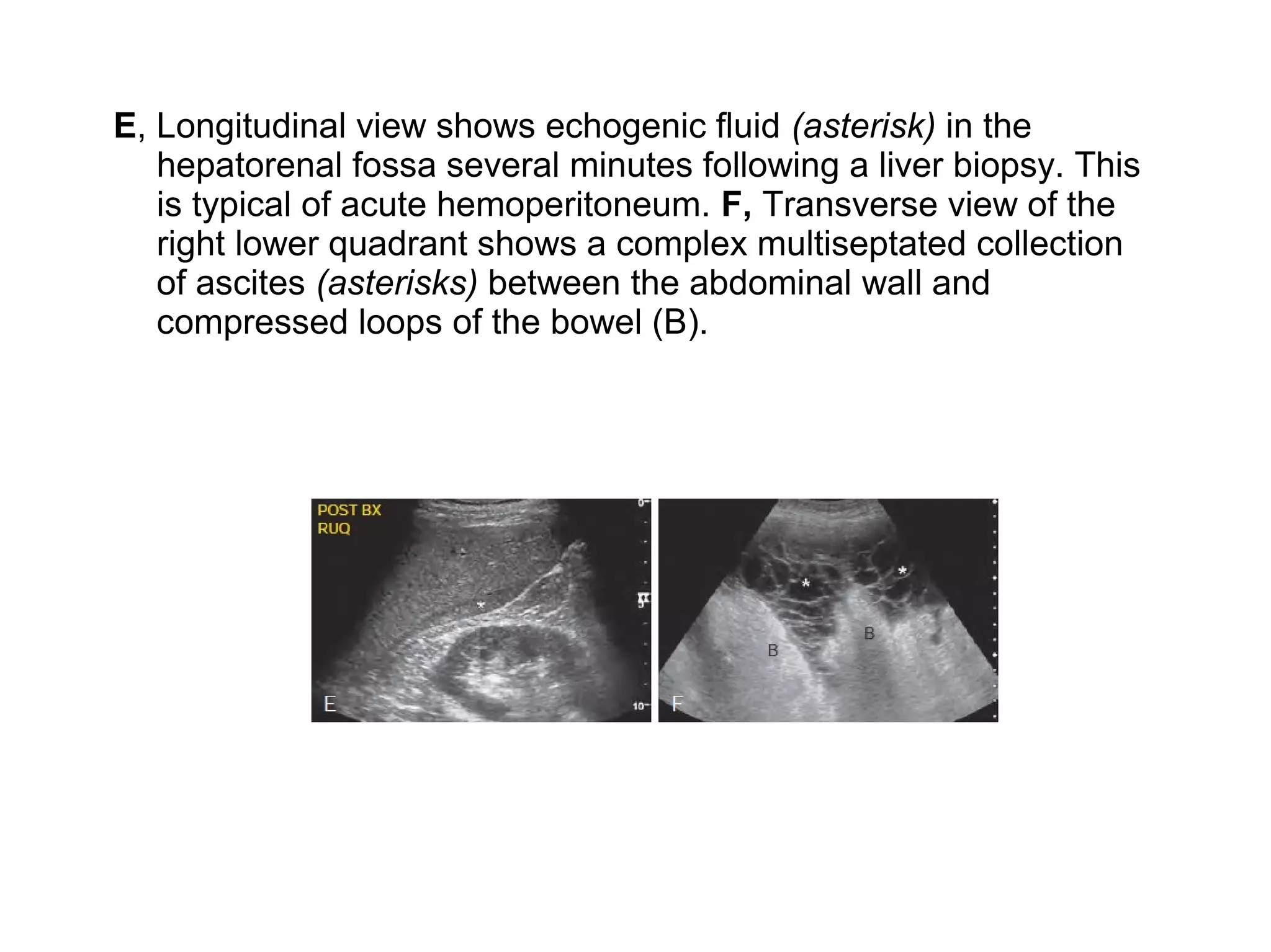 General abdomen ultrasound sonography | PPT