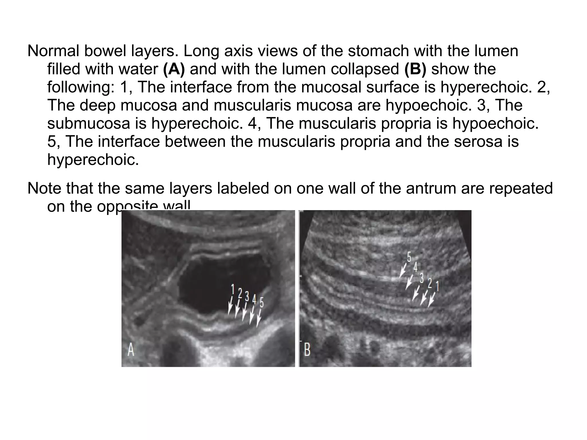 General abdomen ultrasound sonography | PPT