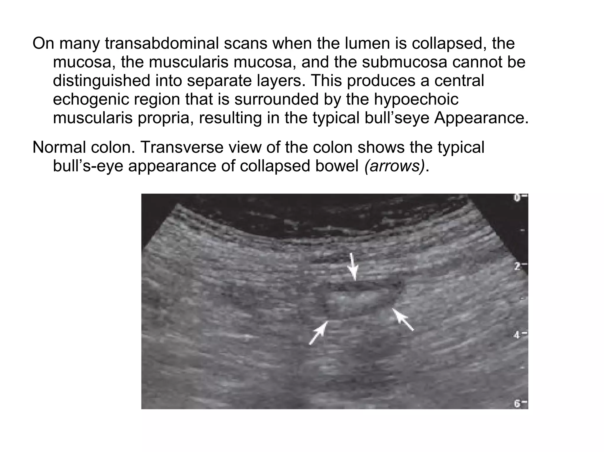 General abdomen ultrasound sonography | PPT