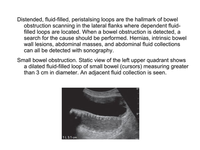 General abdomen ultrasound sonography | PPT