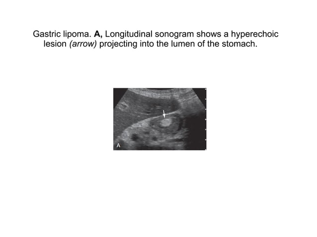 General abdomen ultrasound sonography | PPT