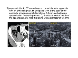 General abdomen ultrasound sonography | PPT