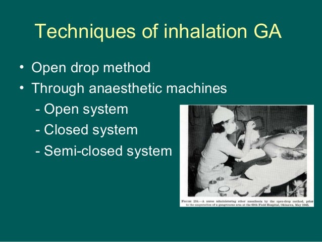 General anaesthesia (New) - drdhriti