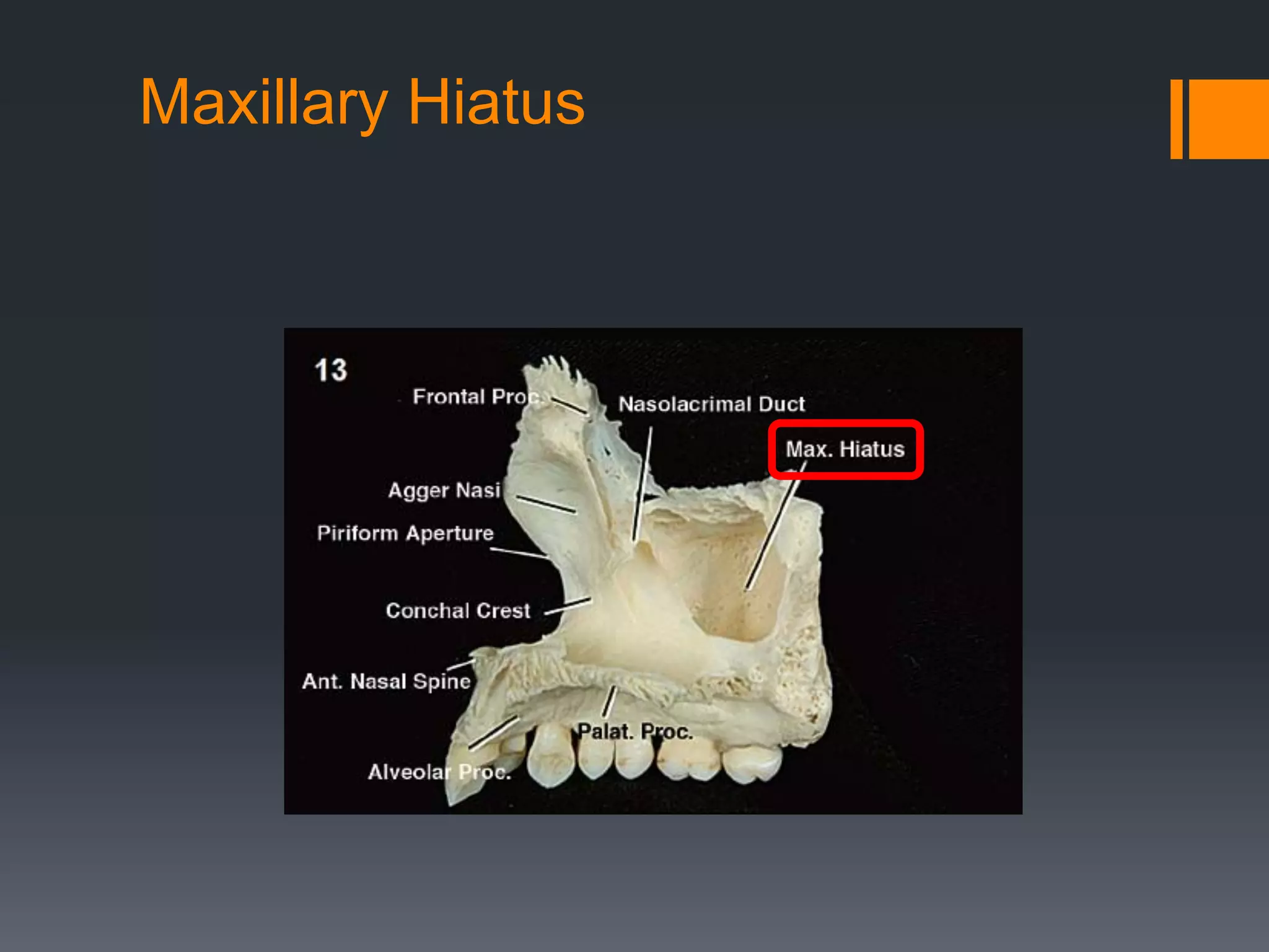 General Anatomy of Bones LT1.pdf | Bone and Joint Conditions | Diseases ...