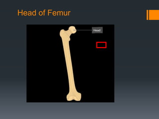 General Anatomy of Bones LT1.pdf