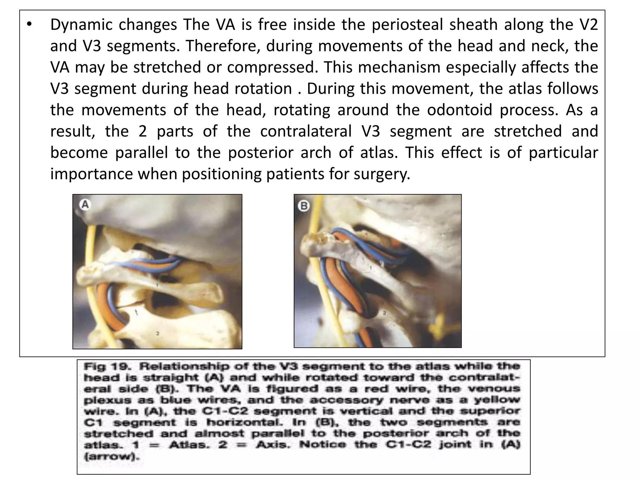 General anatomy of the vertebral artery | PPTX