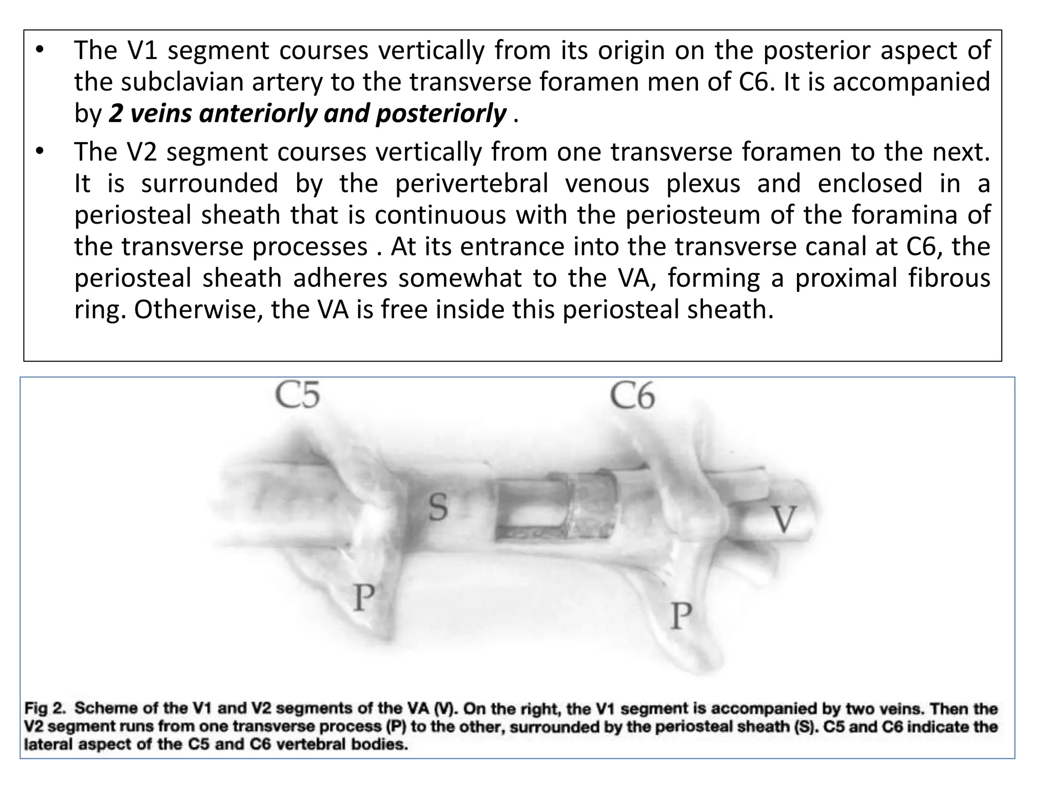General anatomy of the vertebral artery | PPTX