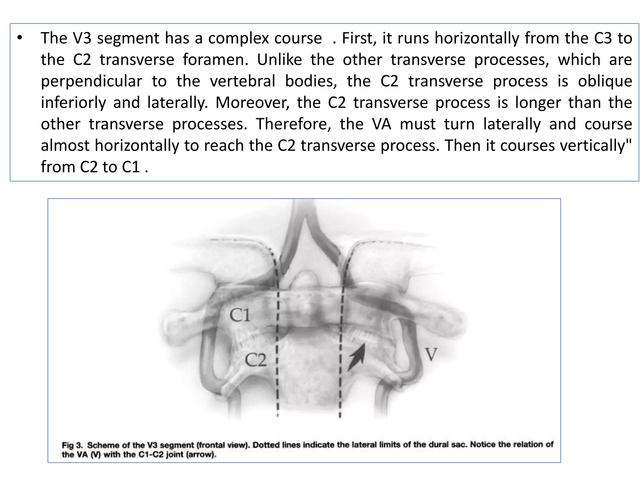 General anatomy of the vertebral artery | PPTX