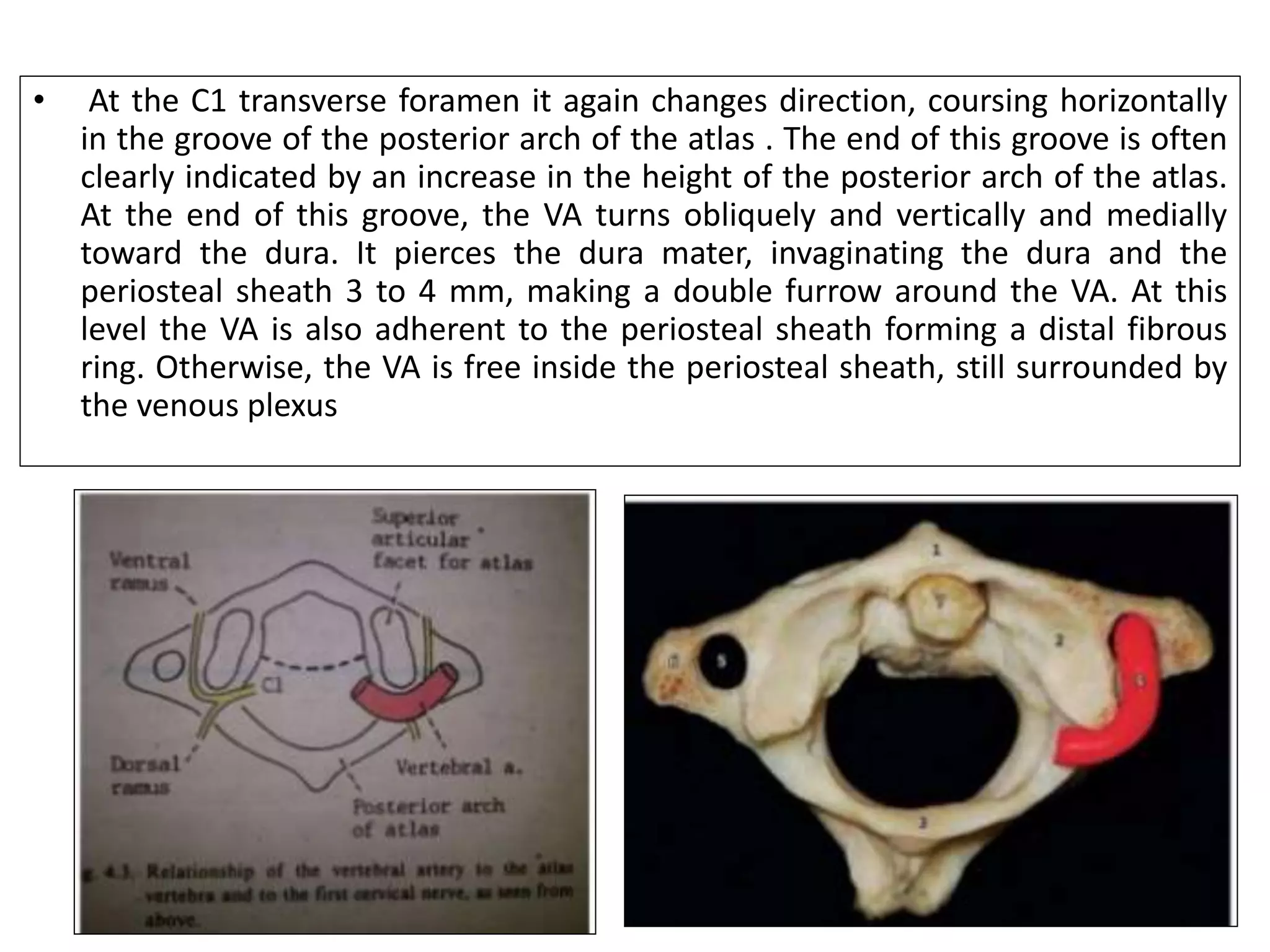 General anatomy of the vertebral artery | PPTX