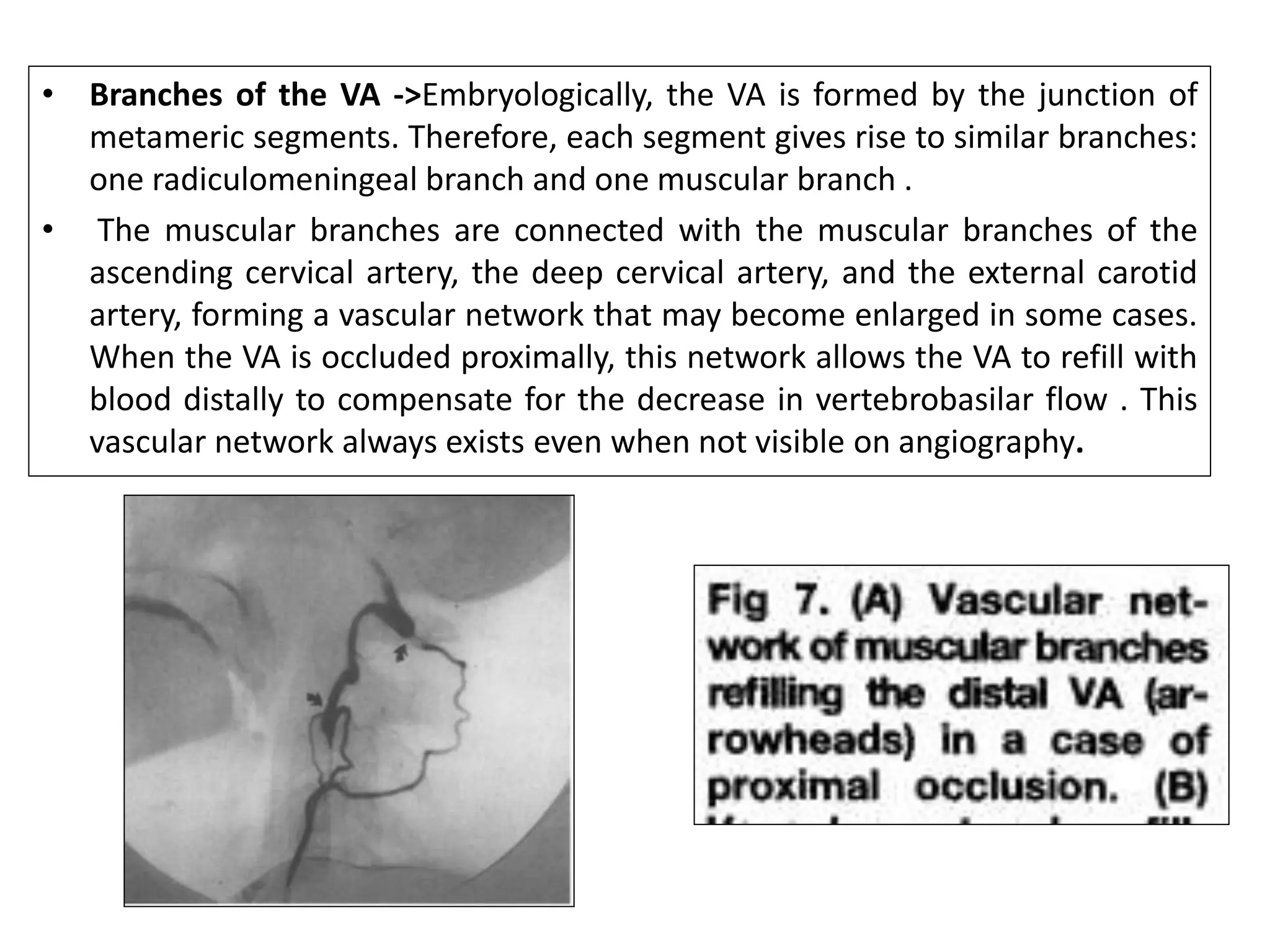 General anatomy of the vertebral artery | PPTX