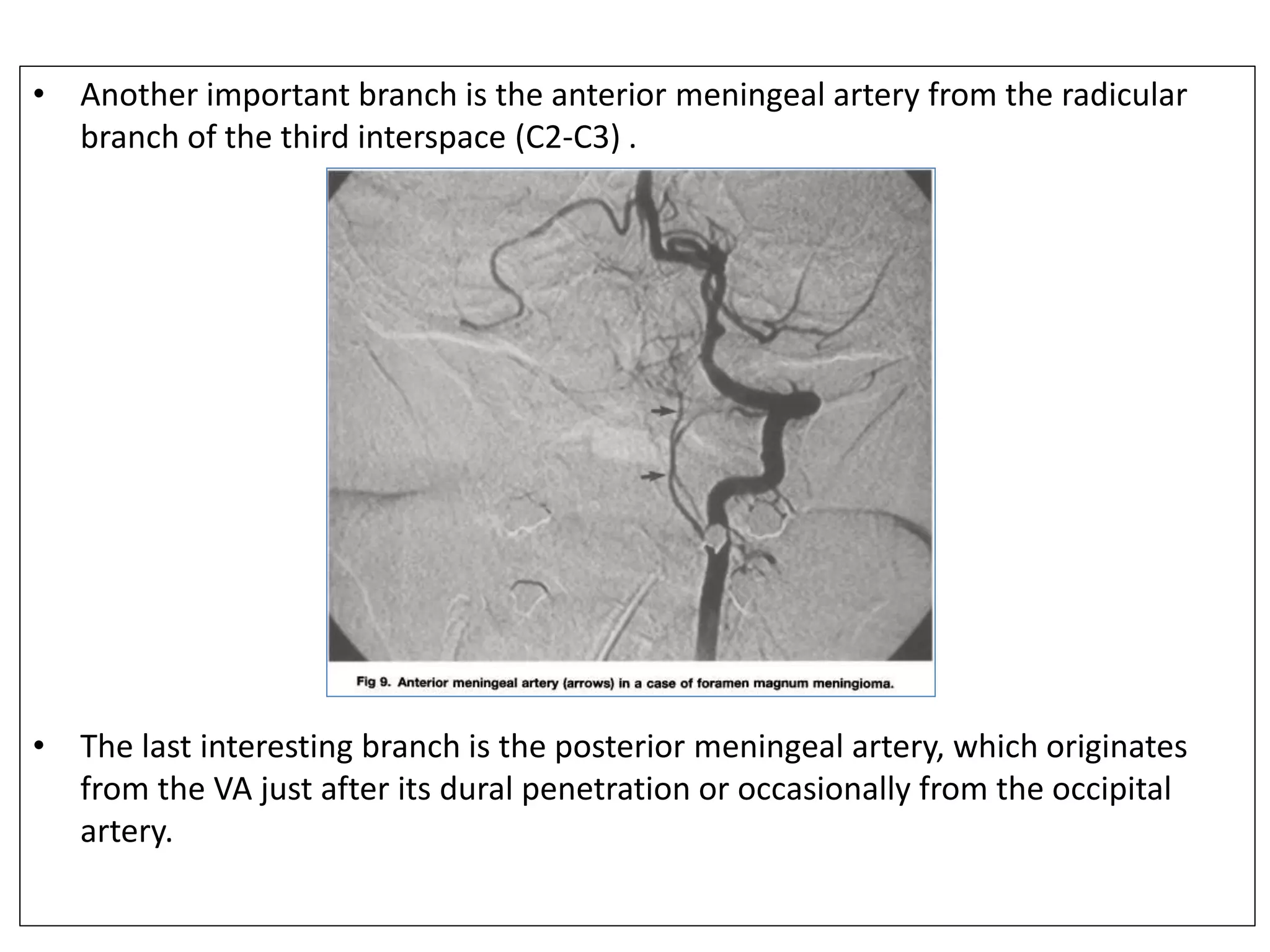 General anatomy of the vertebral artery | PPTX