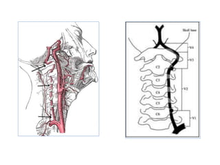 General anatomy of the vertebral artery | PPTX