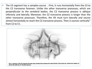 General anatomy of the vertebral artery | PPTX