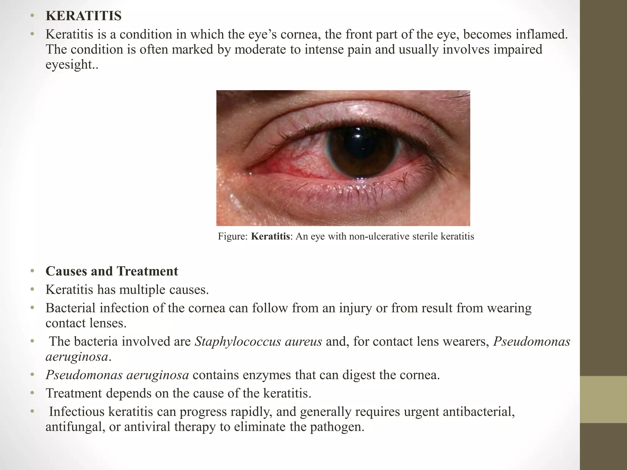 General and Ocular Microbiology.pptx
