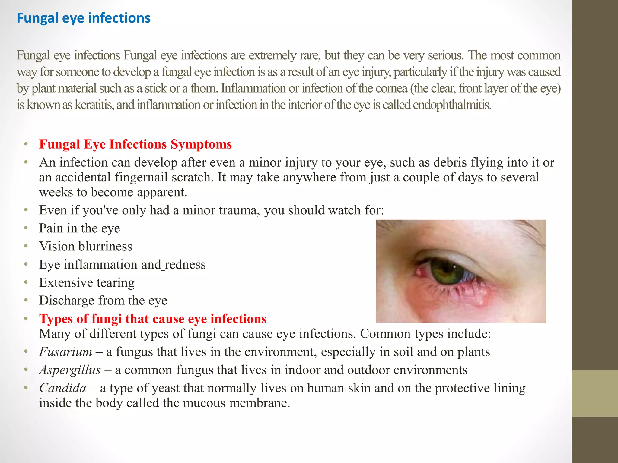 General and Ocular Microbiology.pptx