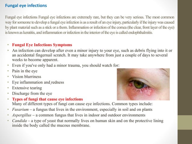 General and Ocular Microbiology.pptx | Eye and Vision Conditions | Diseases and Conditions