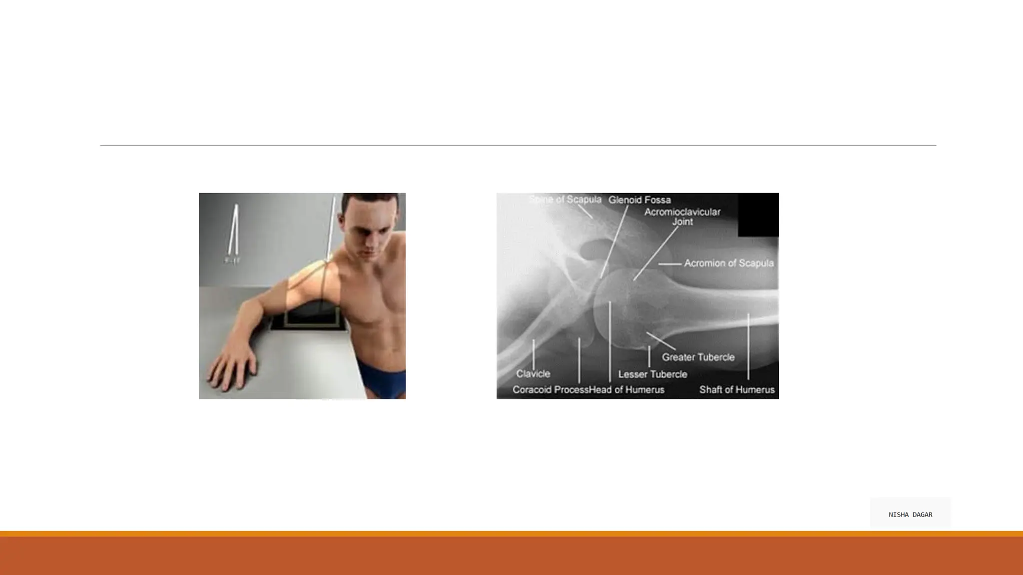 general and special view sof shoulder with general anatomy Nisha Dagar.pdf