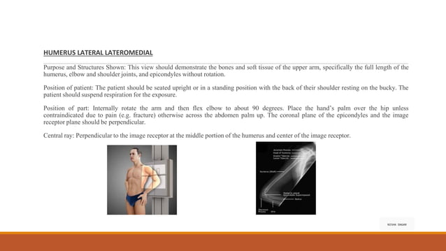 general and special view sof shoulder with general anatomy Nisha Dagar.pdf