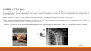 general and special view sof shoulder with general anatomy Nisha Dagar.pdf