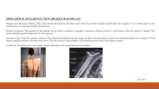 general and special view sof shoulder with general anatomy Nisha Dagar.pdf