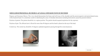 general and special view sof shoulder with general anatomy Nisha Dagar.pdf
