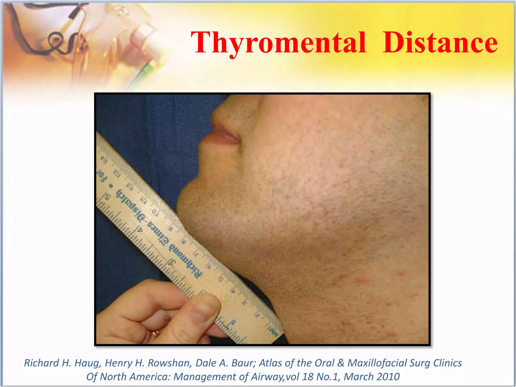 General anesthesia & oral and Maxillofacial Surgery | PPTX