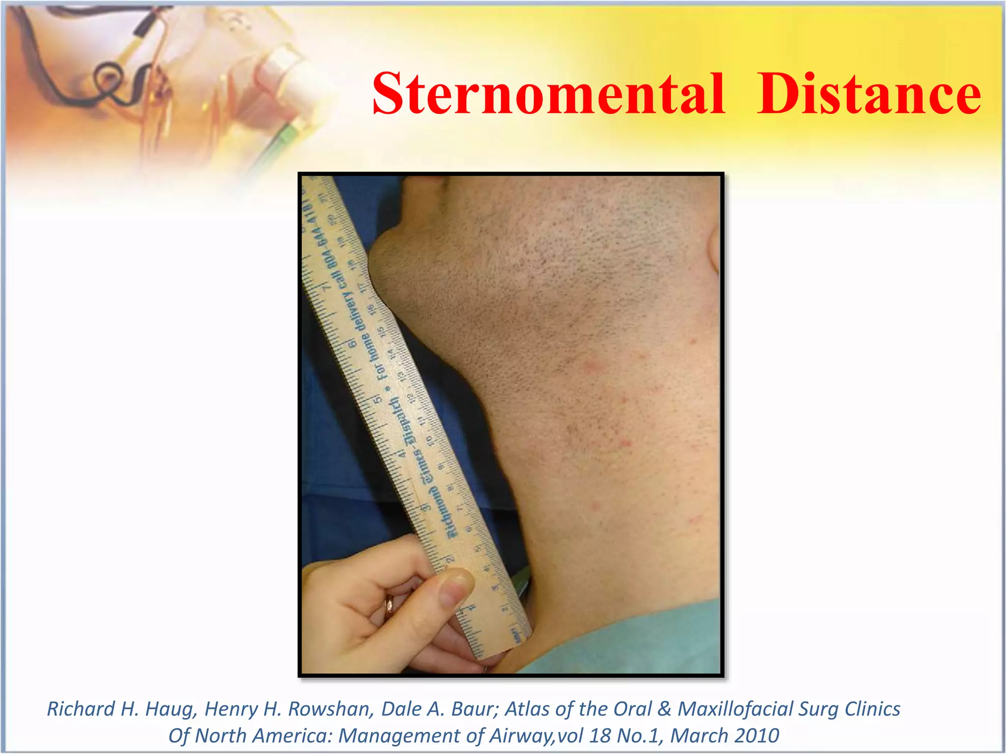 General anesthesia & oral and Maxillofacial Surgery | PPTX