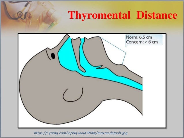 General anesthesia & oral and Maxillofacial Surgery