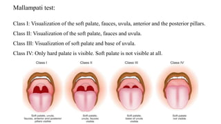 General anesthesia | PPTX