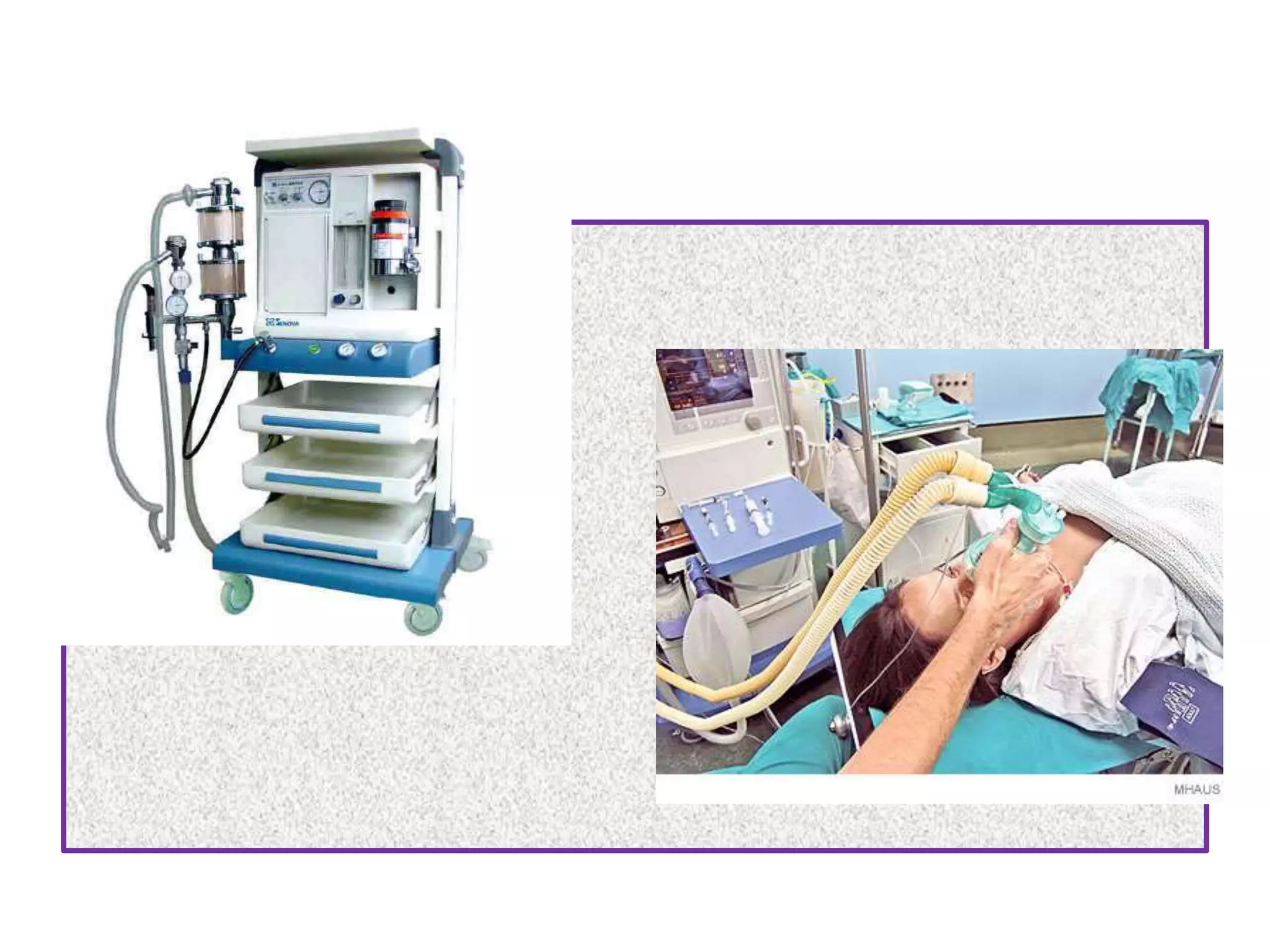 General anesthesia | PPTX