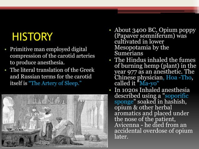 GENERAL ANESTHESIA.pptx